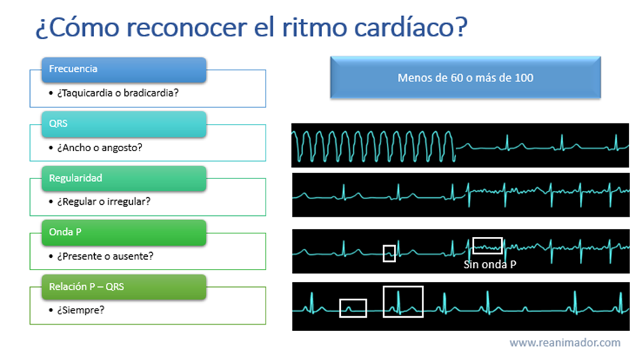 Análisis de Ritmo Cardíaco – Reanimador
